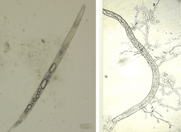 Nemátodos, un patógeno silencioso en el cultivo de arroz - Safer